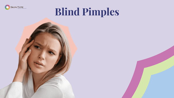 Blind Pimples: How to Get Rid of Those Stubborn Hard Pimples Under the Skin