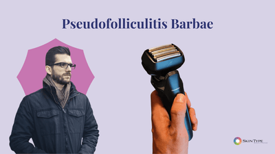 Pseudofolliculitis Barbae Prevention and Treatments