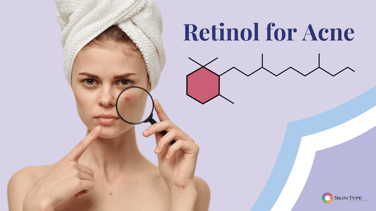 What Does Retinol Do for Acne?