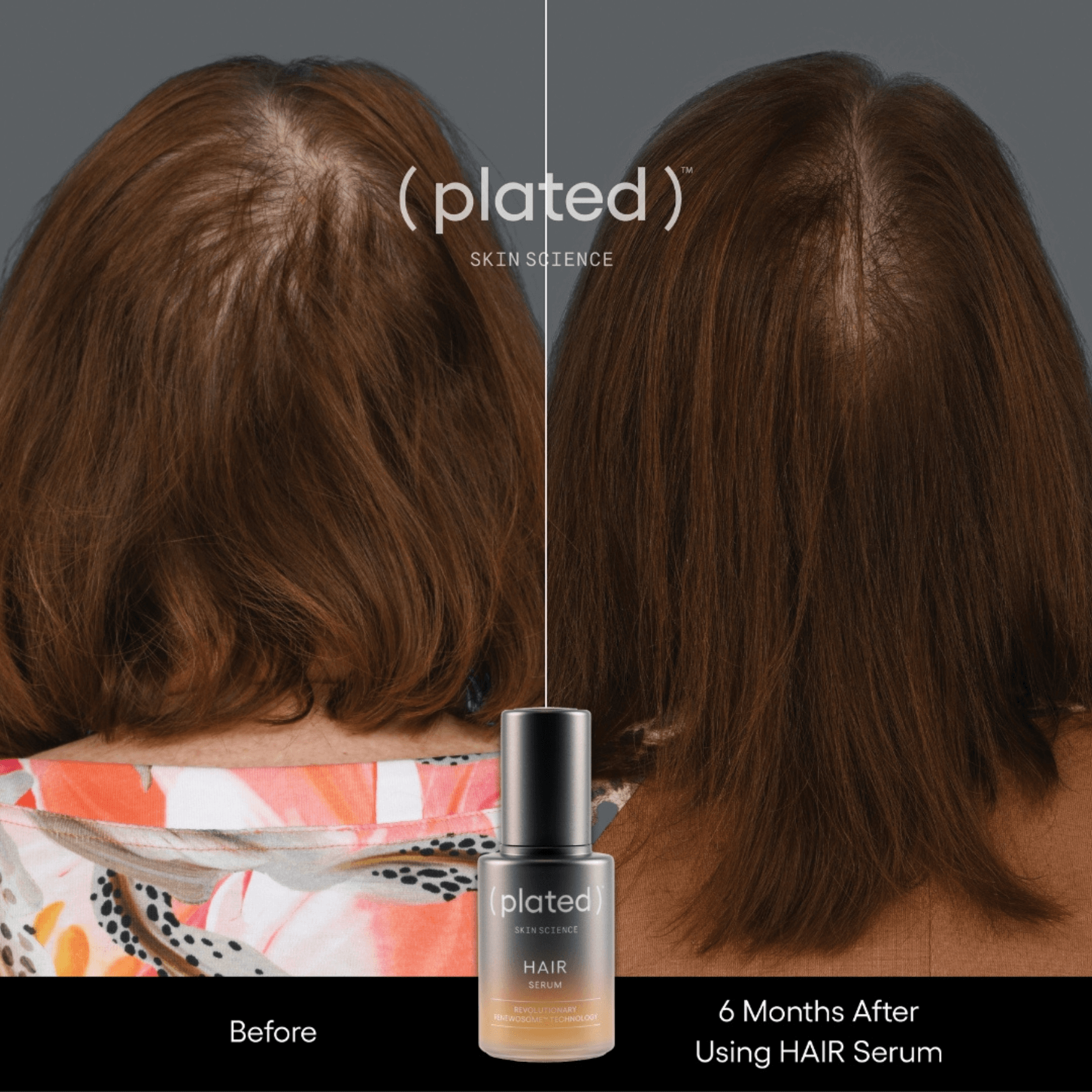 Plated SkinScience – Skin Type Solutions